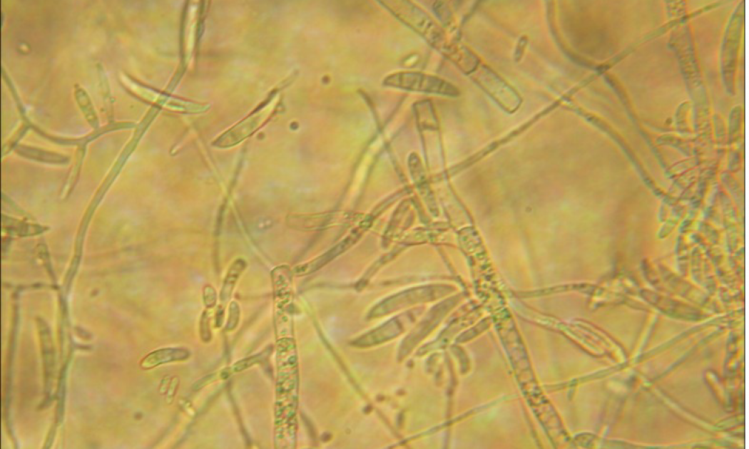 Fusarium: O zákeřném parazitu, ekologii a odpovědnosti | Naše zahrada